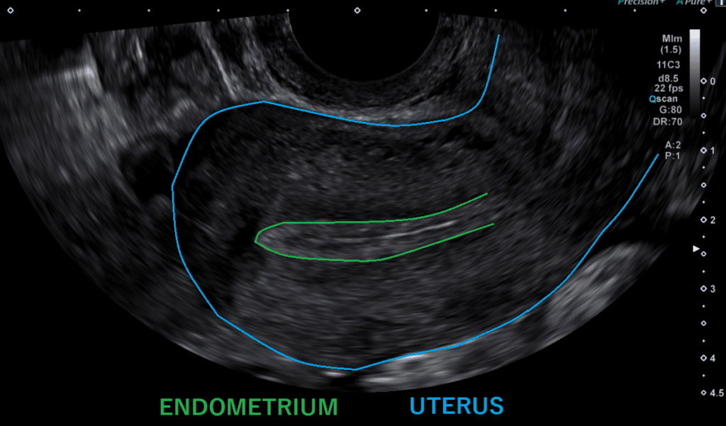 Gynecologic Anchorage | Infertility | Anchorage AK
