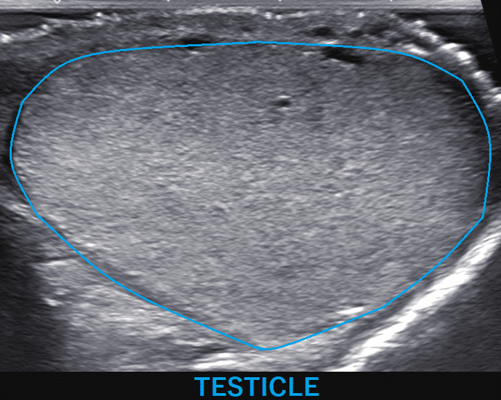 Scrotal Ultrasound | Anchorage | Alaska